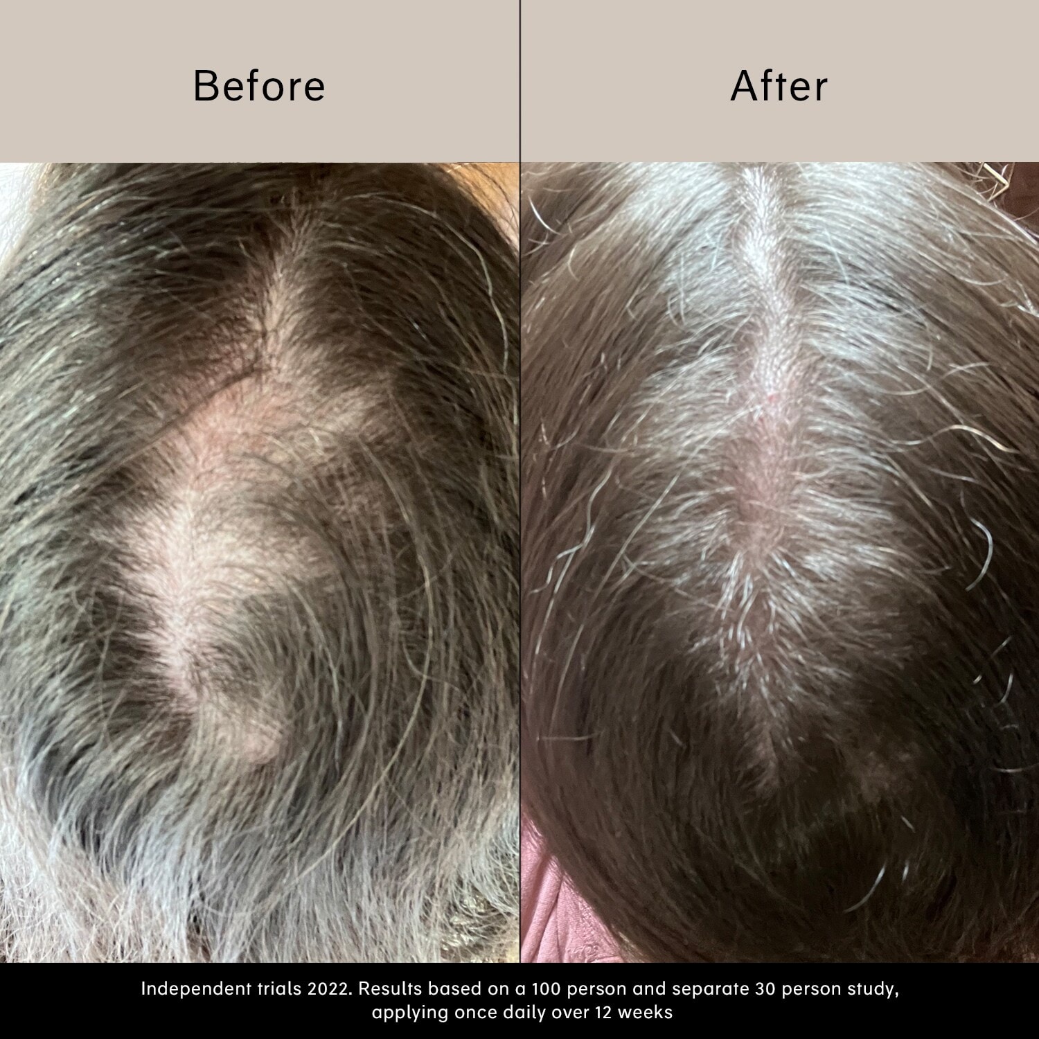 Pitta Growth Serum - Ser pentru crestere CHAMPO ≡ SEPHORA